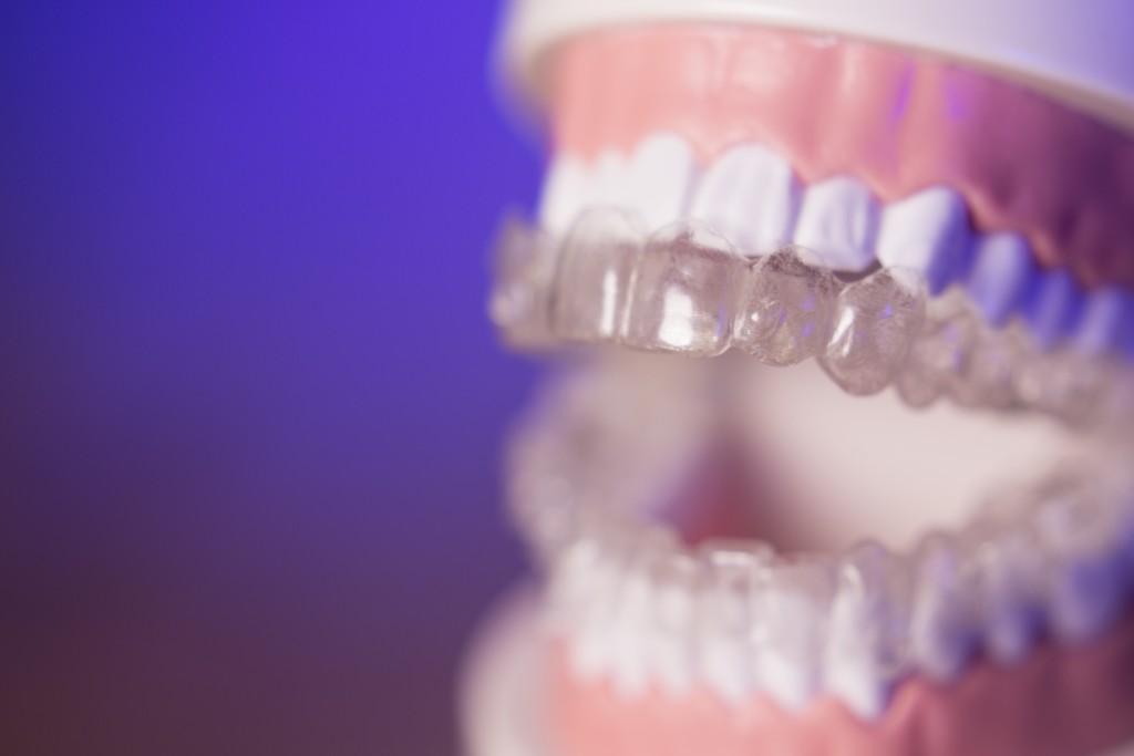 Which Is Better: Invisalign or Metal Braces - The River Guild